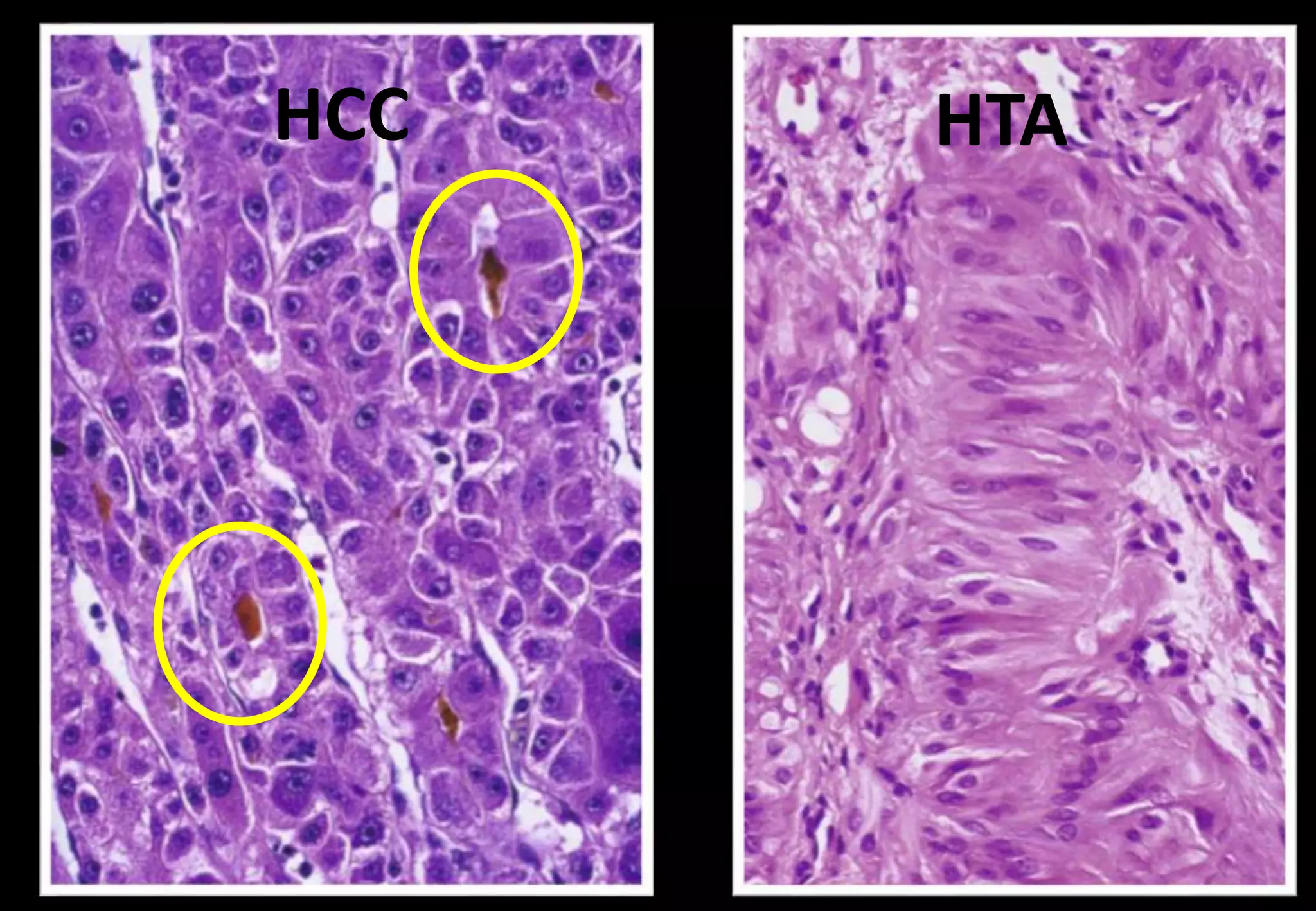 Patterns in histopathology | PPTX