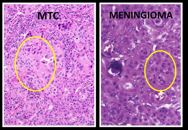 Patterns in histopathology | PPTX | Lung and Respiratory Health ...