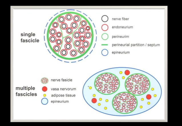 Patterns in histopathology | PPTX | Lung and Respiratory Health ...