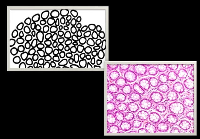 Patterns in histopathology | PPTX | Lung and Respiratory Health ...