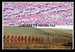 Patterns in histopathology | PPTX