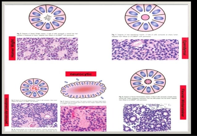 Patterns in histopathology