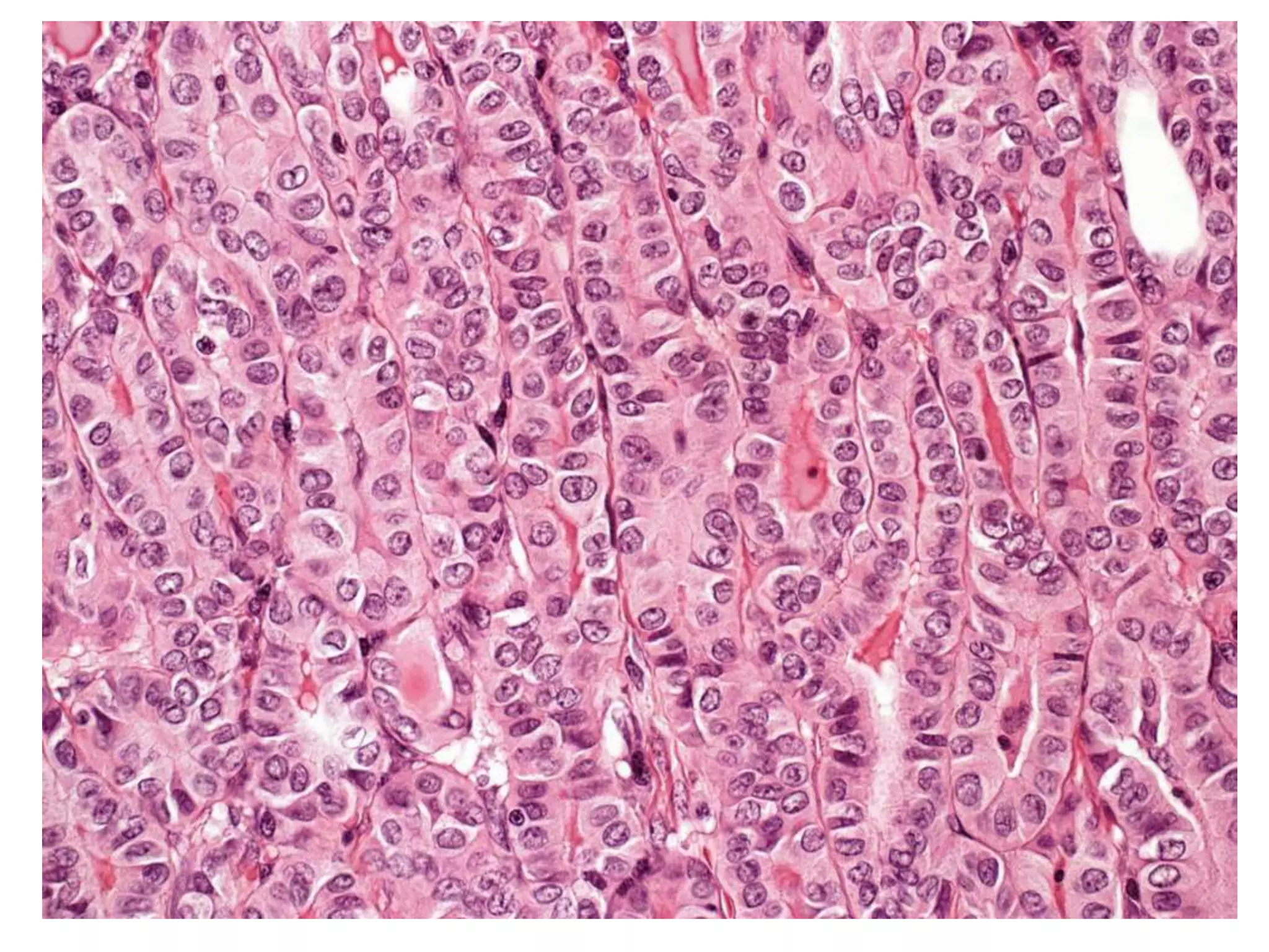 Histopathological Patterns | PPTX