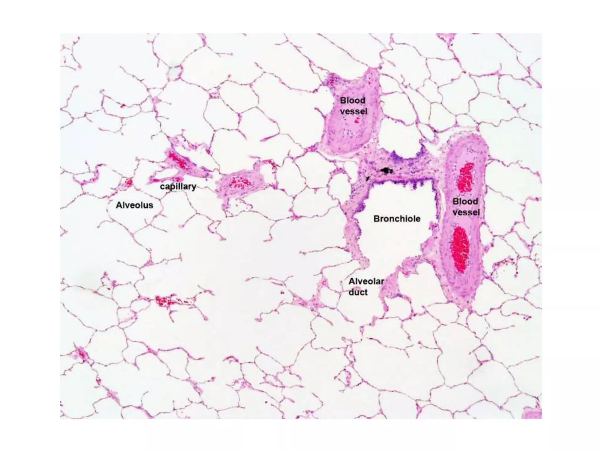 Histopathological Patterns | PPTX