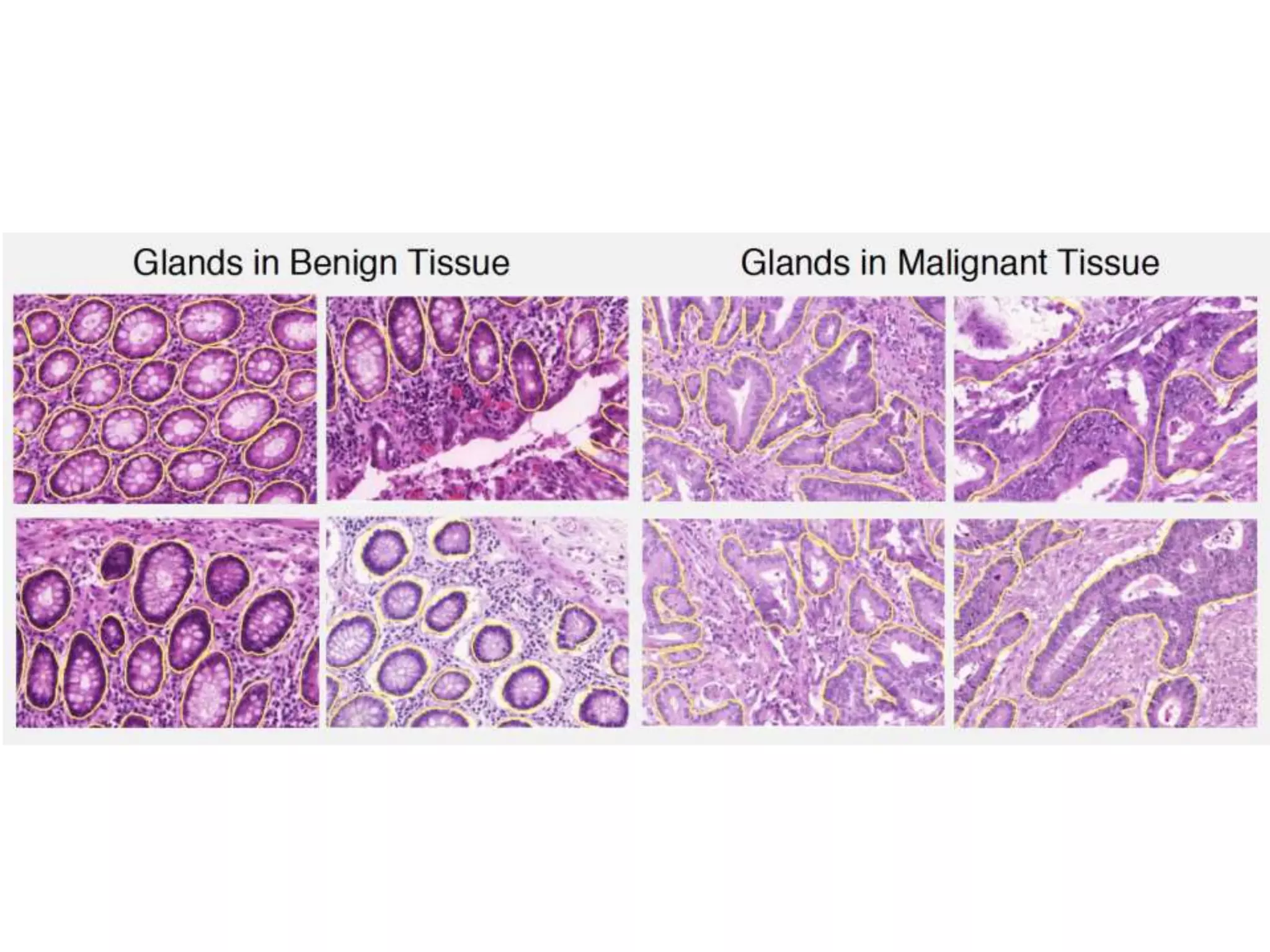 Histopathological Patterns | PPTX