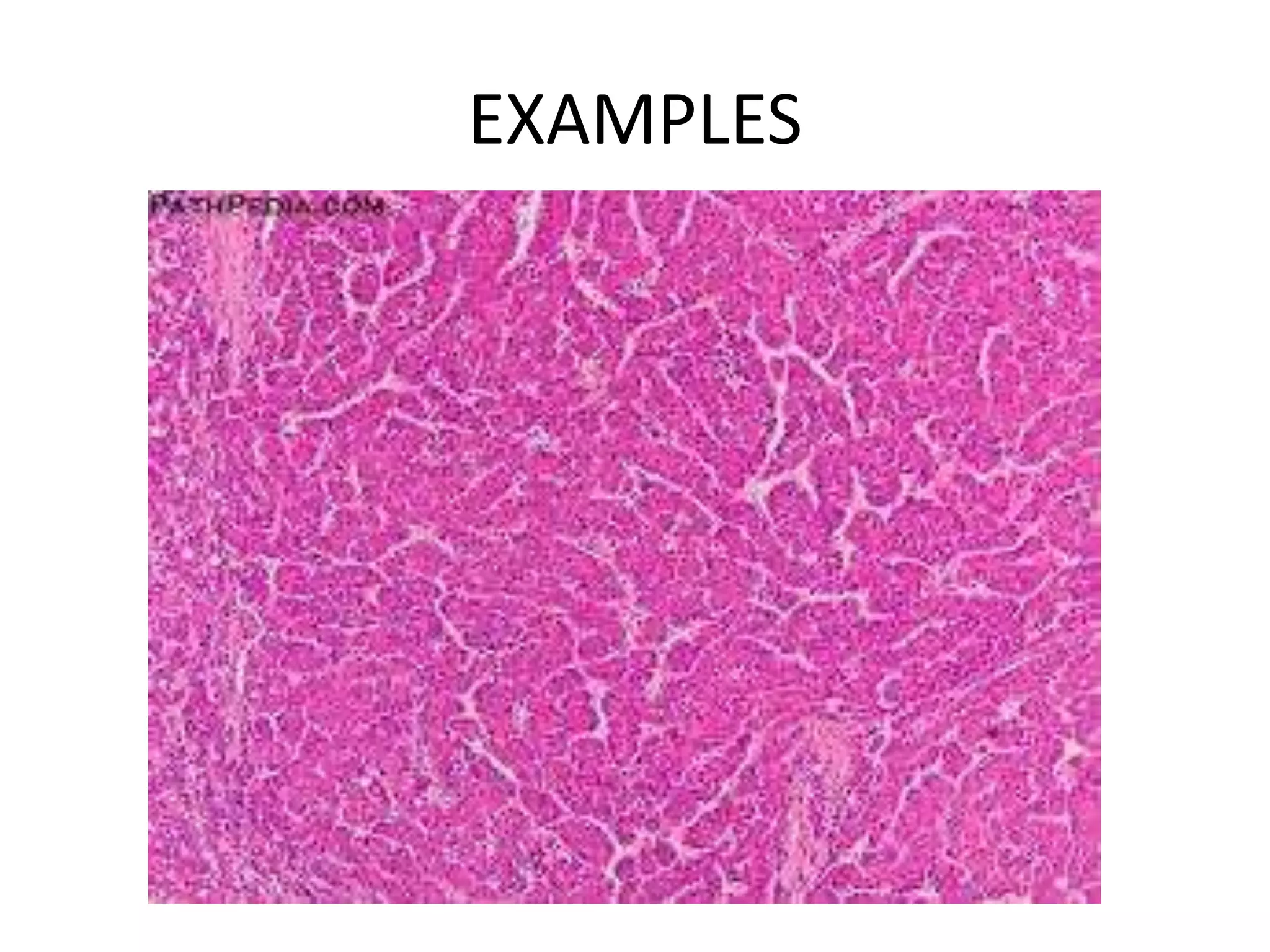Histopathological Patterns | PPTX