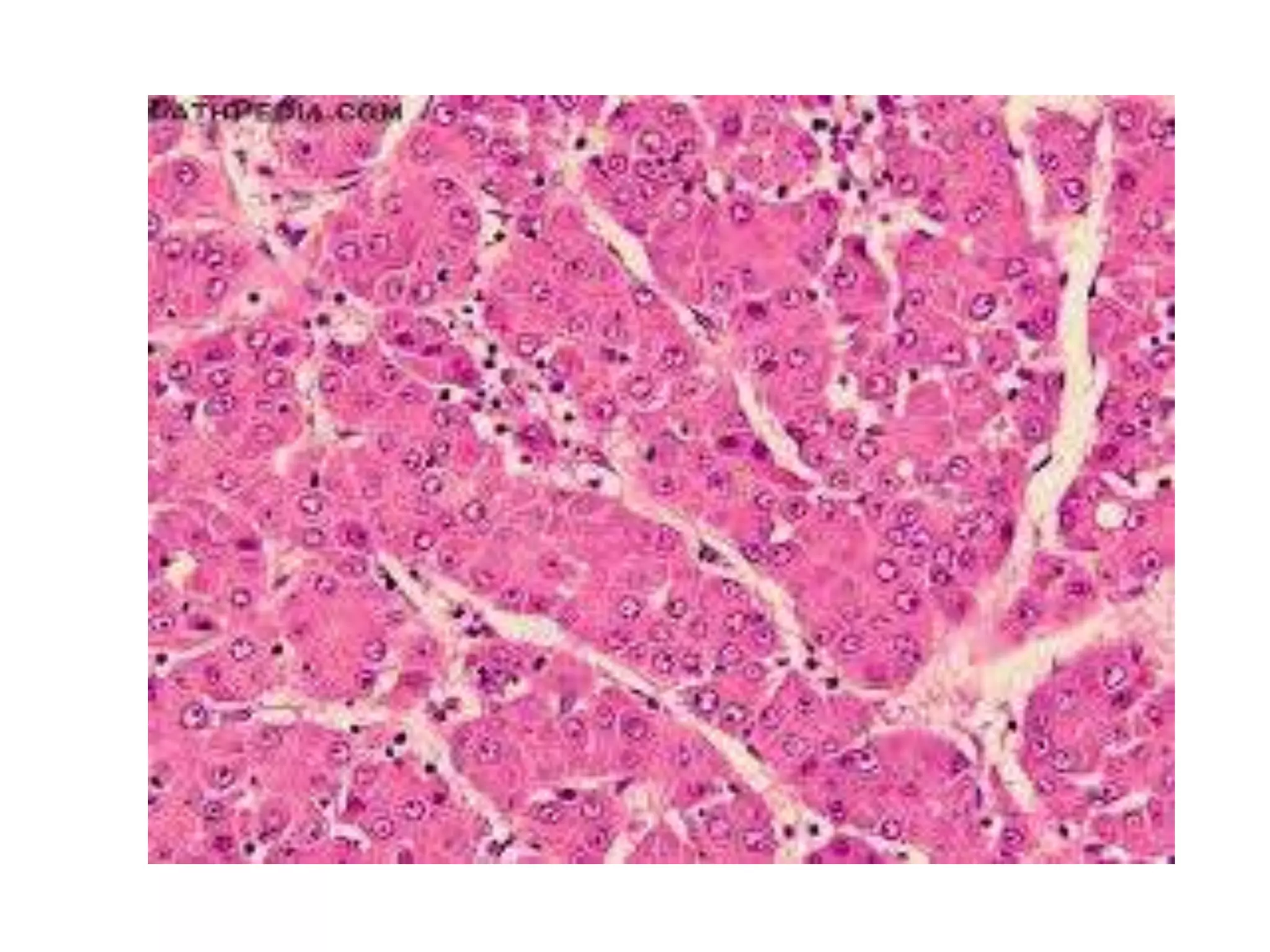Histopathological Patterns | PPTX