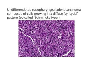 Histopathological Patterns | PPTX