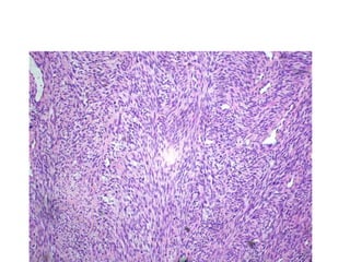 Histopathological Patterns | PPTX