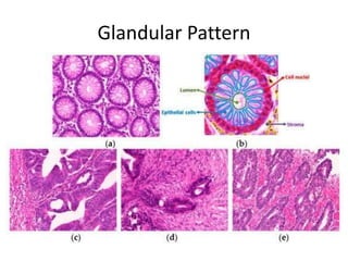 Histopathological Patterns | PPTX