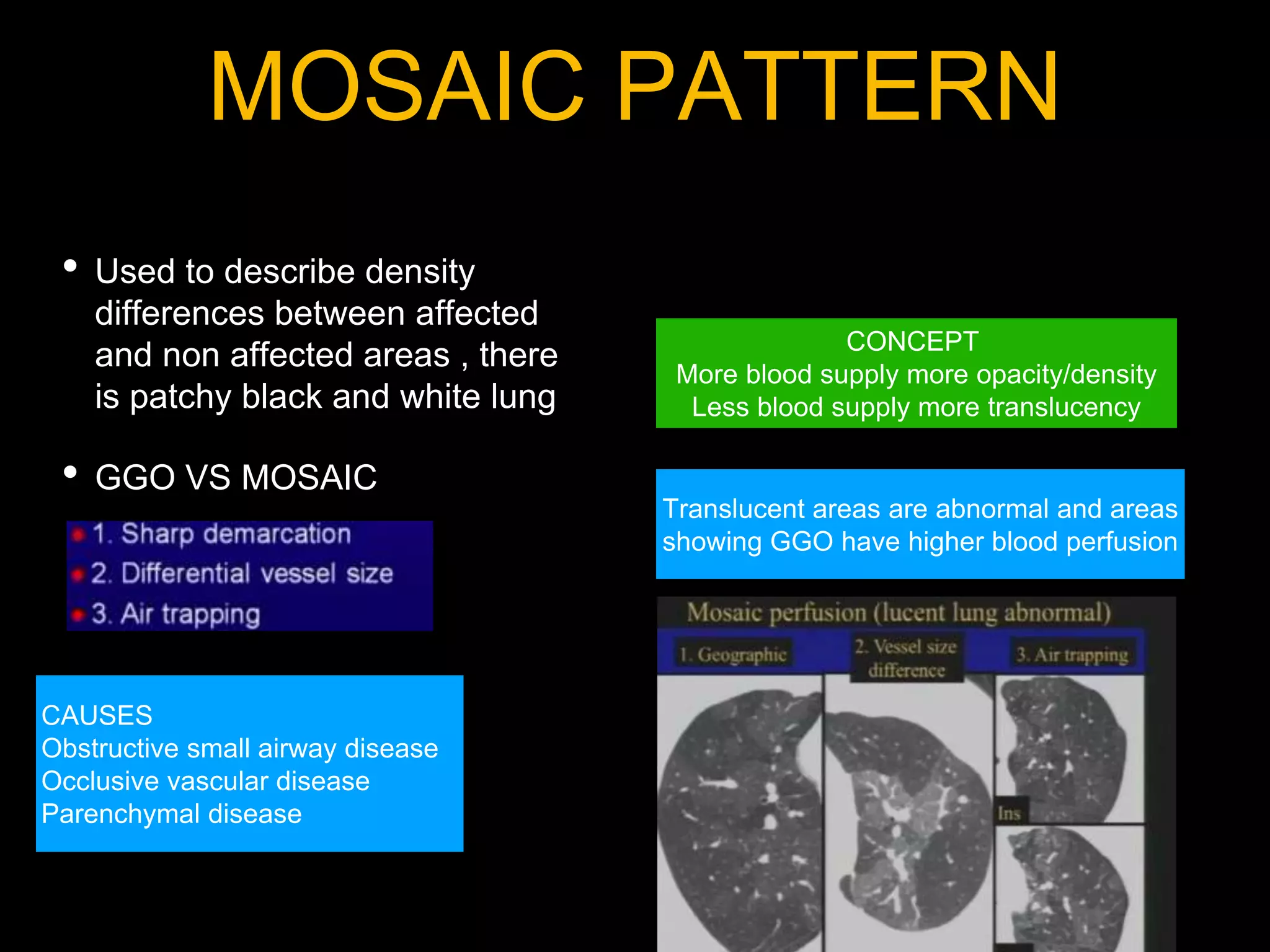Patterns in HRCT chest | PPTX