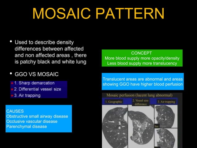 Patterns in HRCT chest | PPTX | Lung and Respiratory Health | Diseases ...