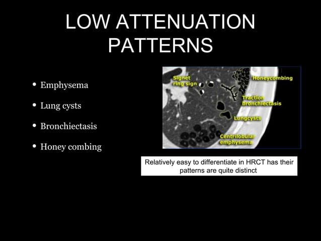 Patterns in HRCT chest | PPTX | Lung and Respiratory Health | Diseases ...