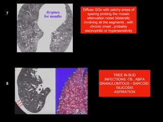 Patterns in HRCT chest | PPTX