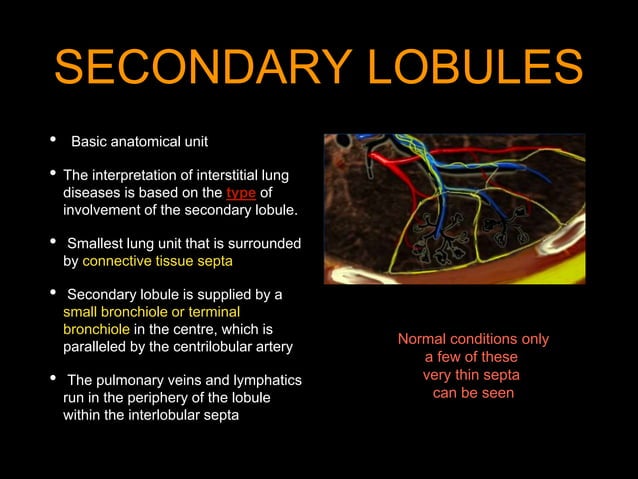 Patterns in HRCT chest | PPTX | Lung and Respiratory Health | Diseases ...