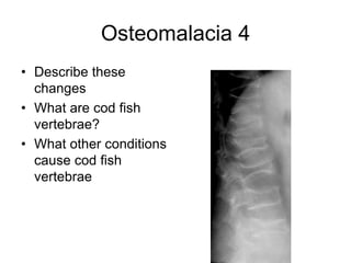 PATTERN SKELETAL 2.ppt