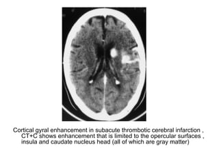 Patterns of Enhancement in the Brain | PPT