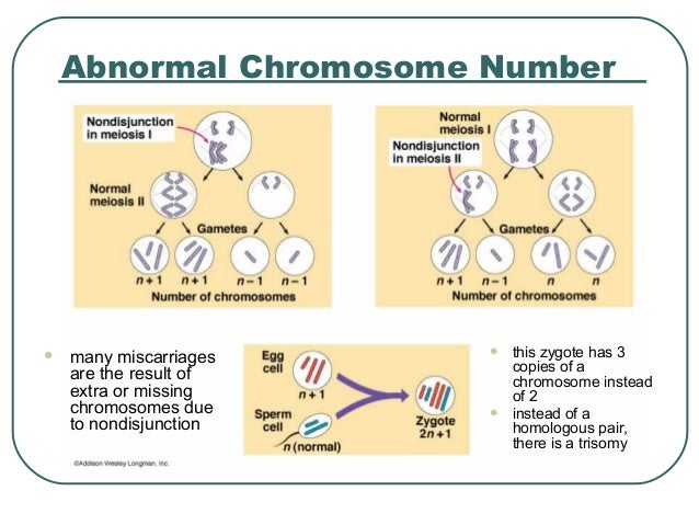 Trisomy 13 on emaze