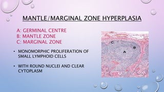 Patterns of lymph node hyperplasia | PPTX