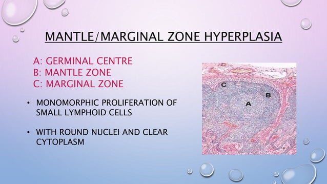 Patterns of lymph node hyperplasia | PPTX