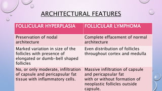 Patterns of lymph node hyperplasia | PPTX