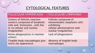 Patterns of lymph node hyperplasia | PPTX