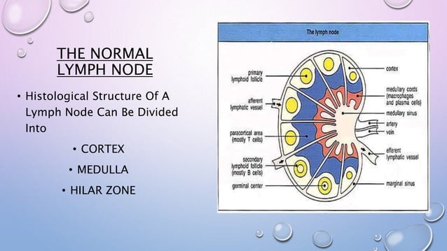 Patterns of lymph node hyperplasia | PPTX