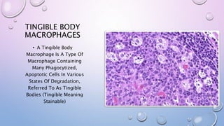 Patterns of lymph node hyperplasia | PPTX