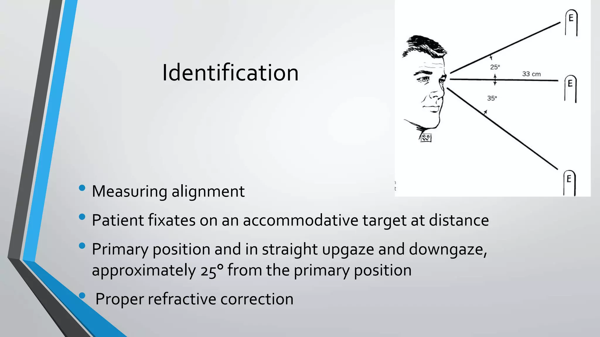 Pattern strabismus | PPTX
