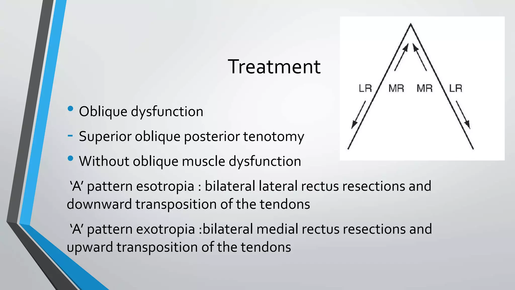 Pattern strabismus | PPTX