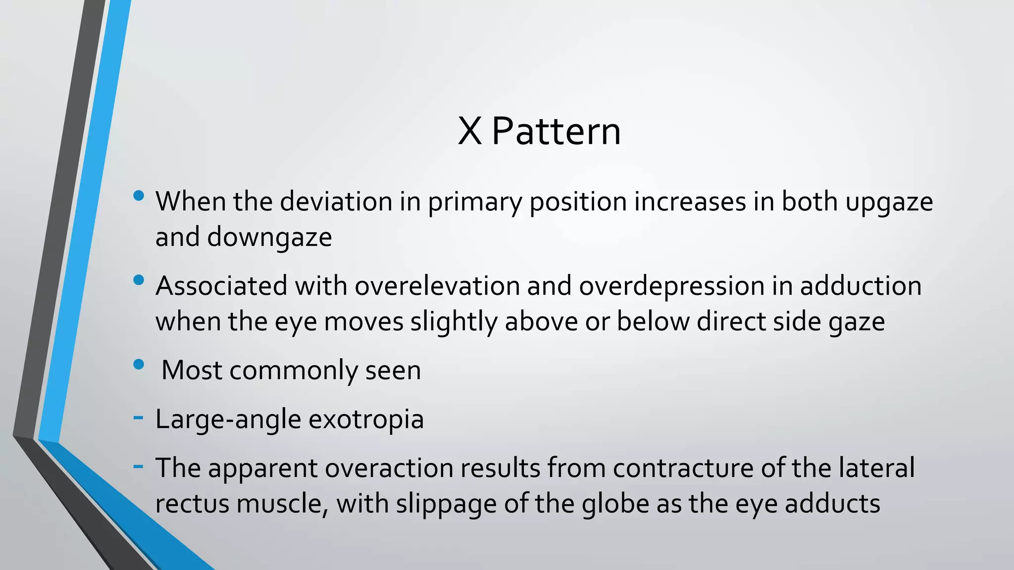 Pattern strabismus | PPTX