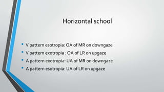 Pattern strabismus | PPTX