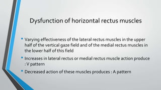 Pattern strabismus | PPTX