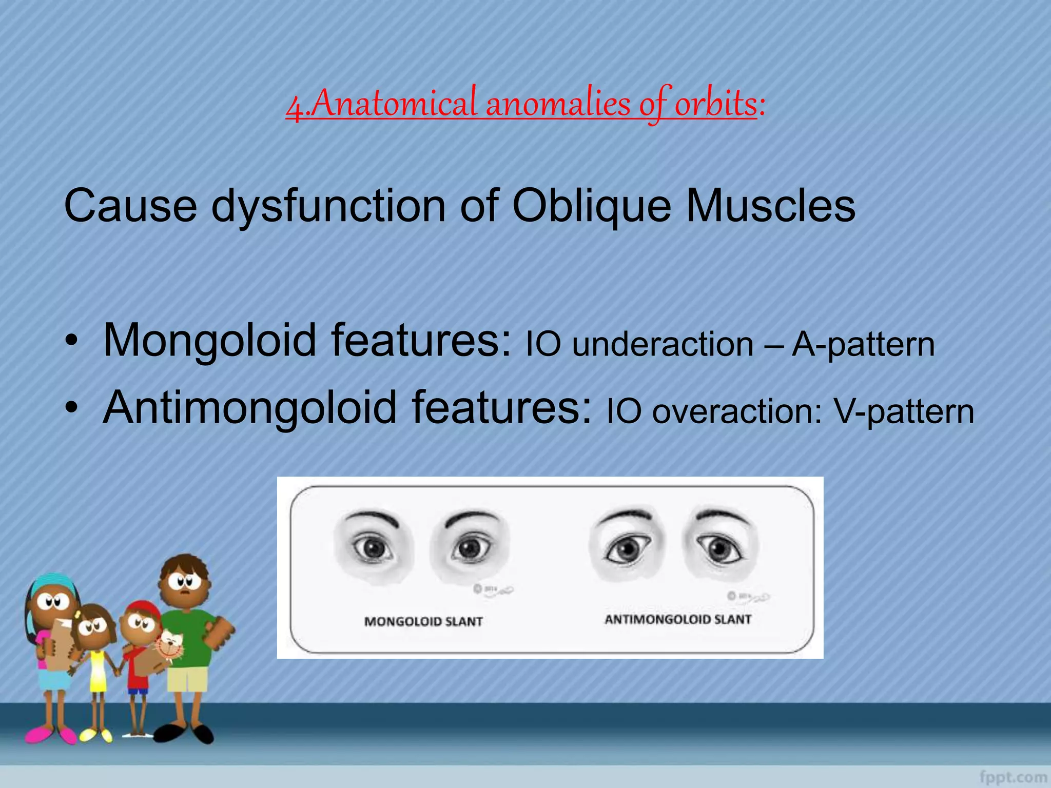 Pattern Strabismus.ppt
