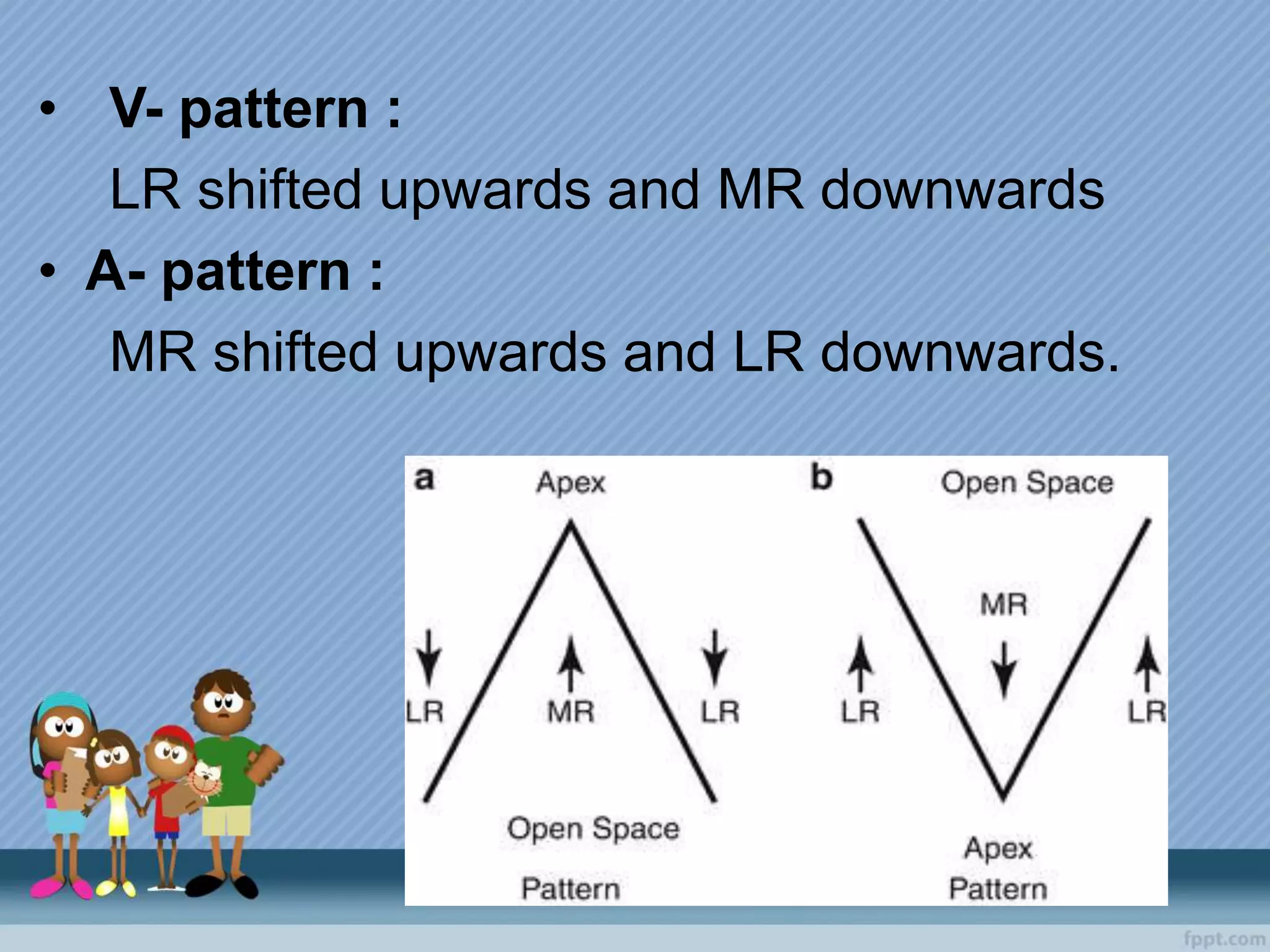 Pattern Strabismus.ppt