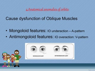 Pattern Strabismus.ppt