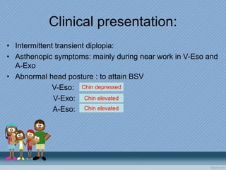 Pattern Strabismus.ppt