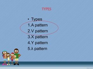 Pattern Strabismus.ppt
