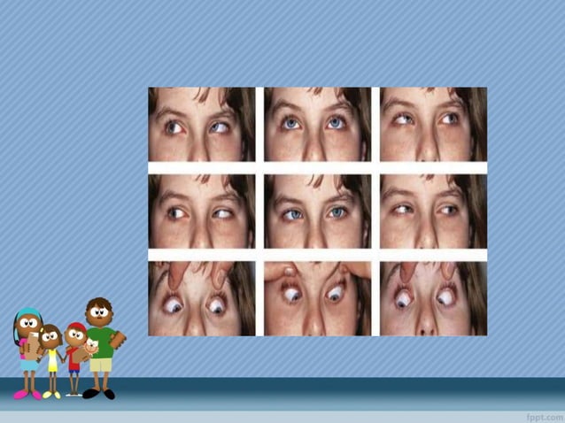 Pattern Strabismus.ppt