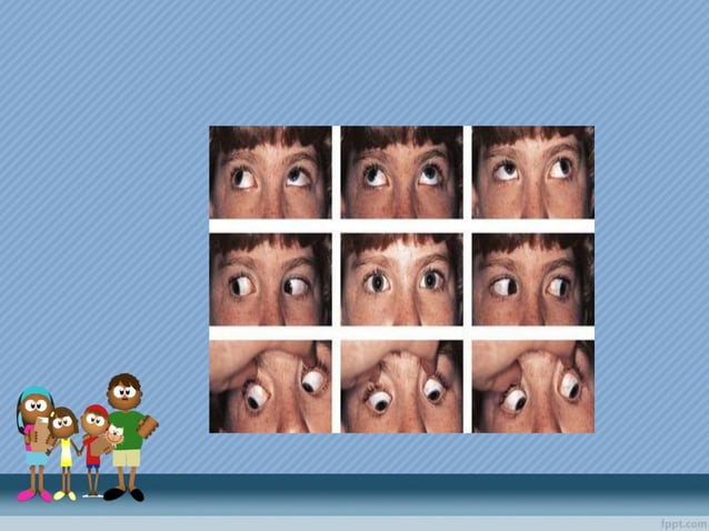 Pattern Strabismus.ppt