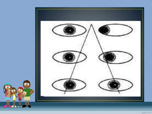 Pattern Strabismus.ppt