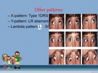 Pattern Strabismus.ppt