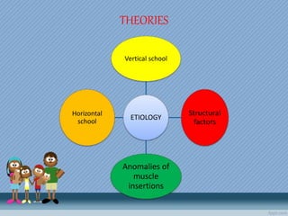 Pattern Strabismus.ppt