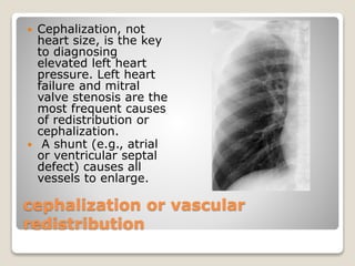 Patttern of lung disease on chest x ray | PPTX