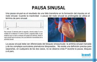 PAUSABLOQUEO diana.pptx