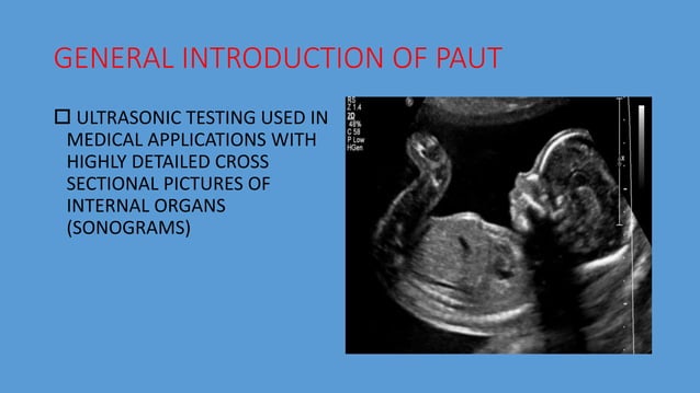 PAUT.pptx
