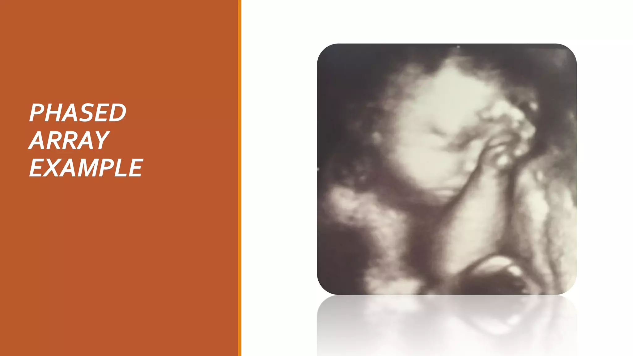 Phased Array Ultrasonic Testing Presentation | PDF