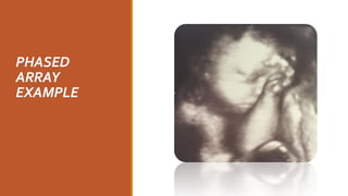 Phased Array Ultrasonic Testing Presentation | PDF