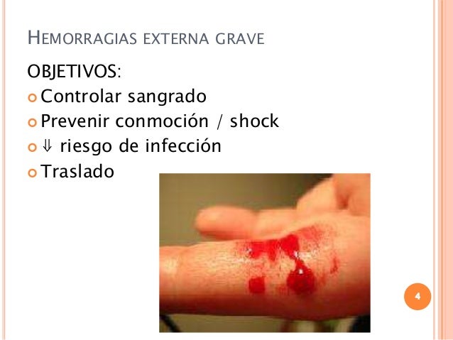 Hemorragia Externa