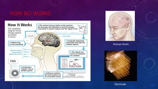 Brain Computer Interface (Bci) | PPTX
